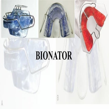 Bionator | PPT