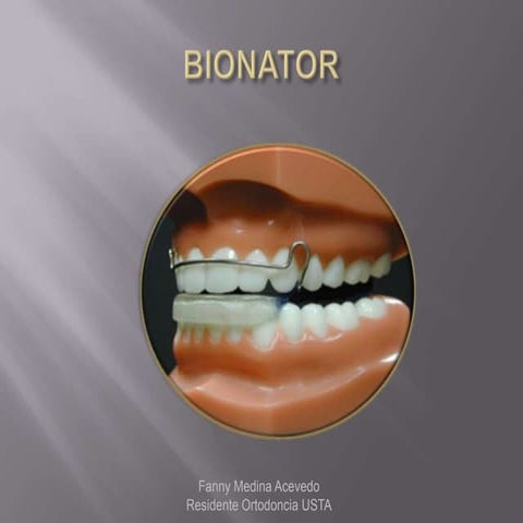 Bionator | PPT