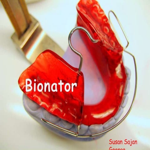 Bionator | PPT