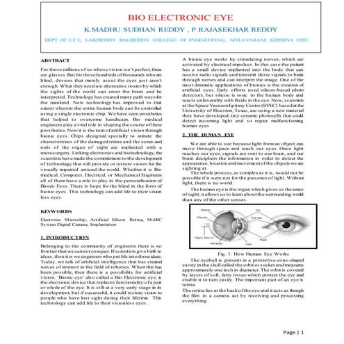 Bionic eye | PDF