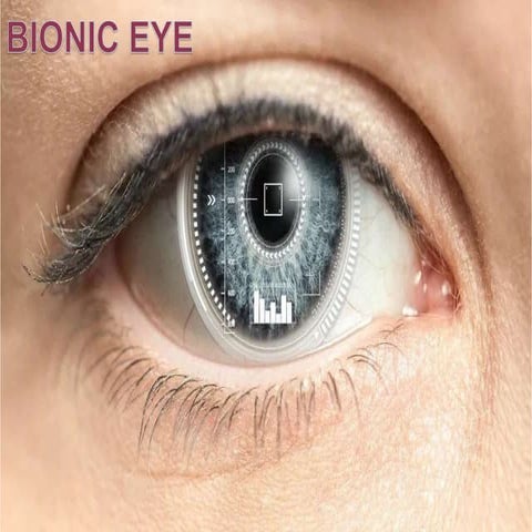 Bionic EYE | PPTX