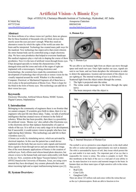 Bionic eye | DOCX | Eye and Vision Conditions | Diseases and Conditions