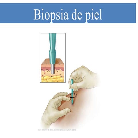 BIOPSIA DE PIEL.pptx