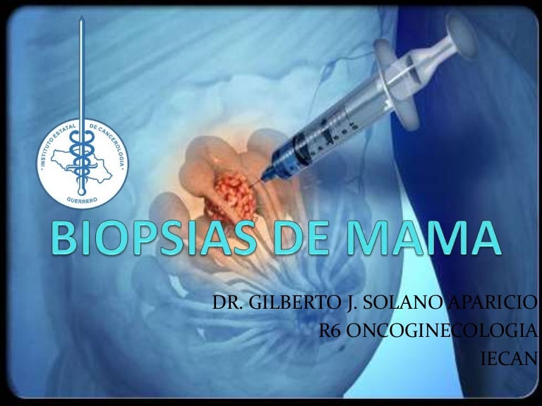 Biopsia mama