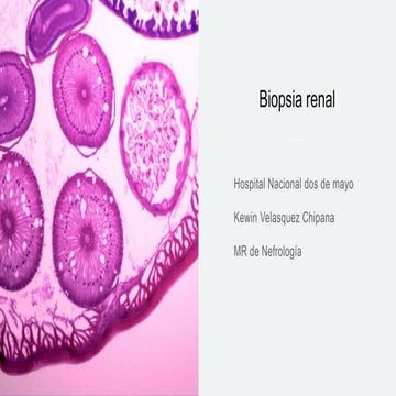 Biopsia renal es un procedimiento diagnostico | PPTX