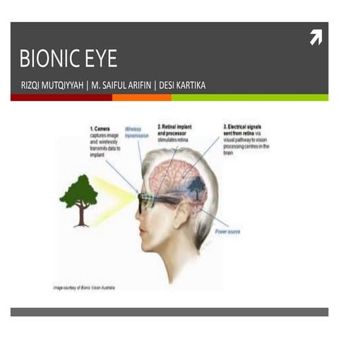 Bionic Eye | PPTX