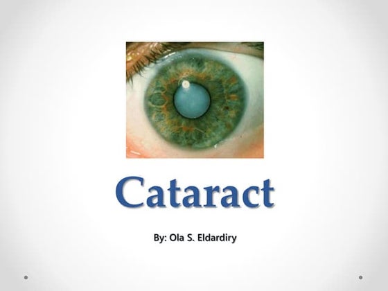 Cataracts | DOCX | Eye and Vision Conditions | Diseases and Conditions