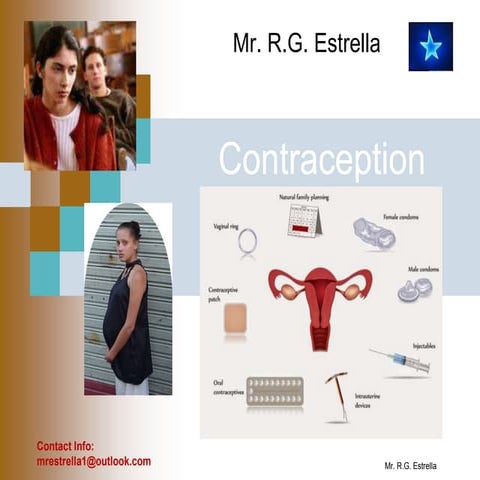 Contraception | PPTX