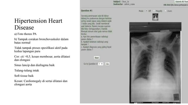 Bagaimana cara membaca foto rontgen/x-ray | PPT