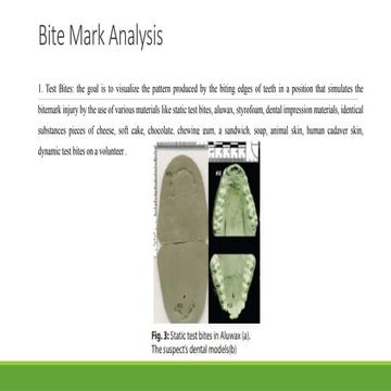 Bite Marks (FORENSIC DENTISTRY) | PPTX