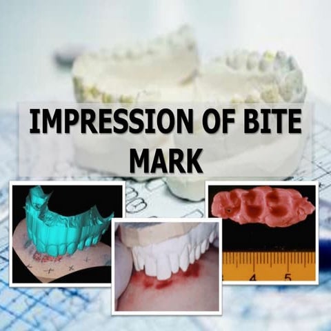 Bite Marks (FORENSIC DENTISTRY) | PPTX