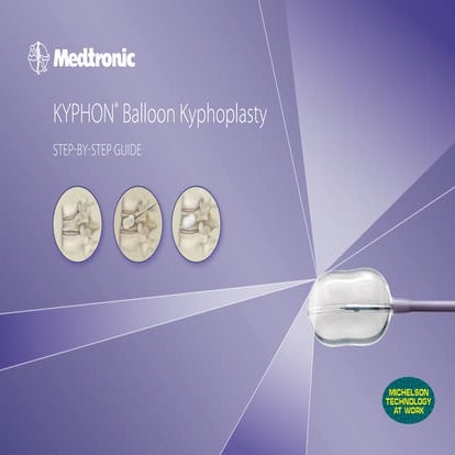 Balloon Kyphoplasty Step By Step Procedure Guide | PDF