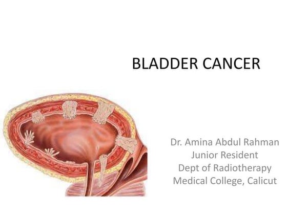 Bladder cancer | PDF | Cancer | Diseases and Conditions