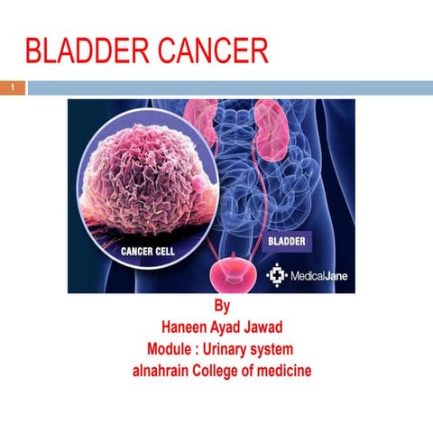 Bladder cancer | PPTX