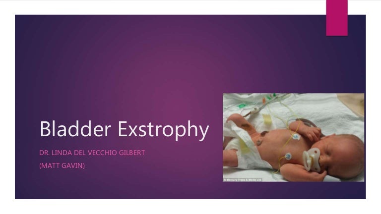Bladder exstrophy