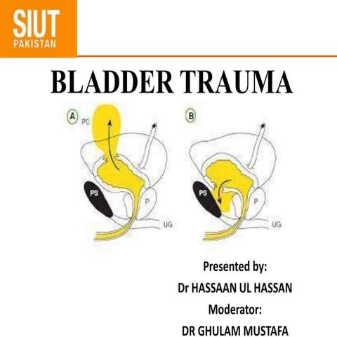 Bladder trauma ff.pptx | Death, Injury, or Military Conflict ...