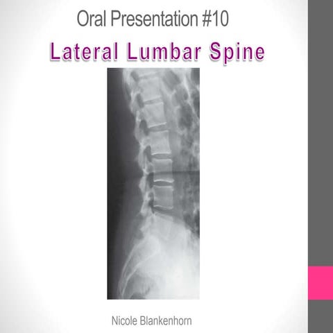 Radiographic views of lumbar spine | PPTX