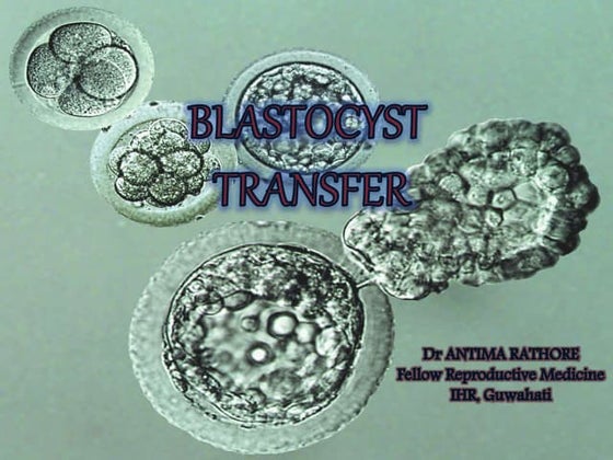 The IVF Journey | PPTX | Infertility | Reproductive Health