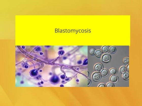 BLASTOMYCOSIS.pptx prepare by rehan asghar | PPTX | Infectious Diseases | Diseases and Conditions