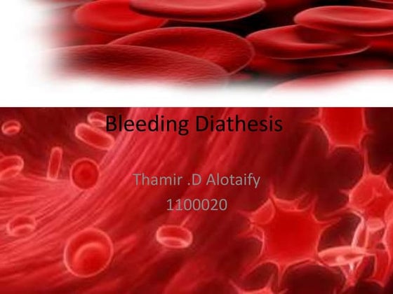 Bleeding Disorders: Classification and Diagnosis | PPT