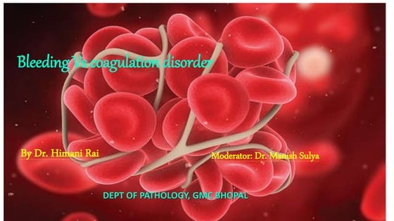 VIGNESHWARAN SJ bleeding disorder cardiac technology | PPT