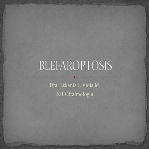 Blefaroptosis | PPTX