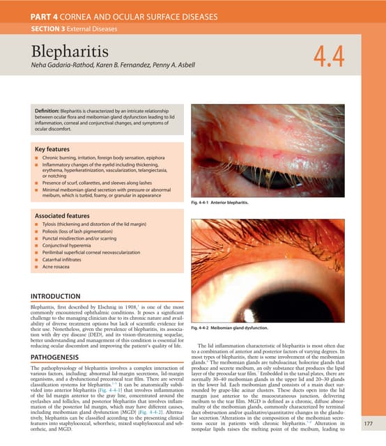 Clinical anatomy of the eyelids | PDF