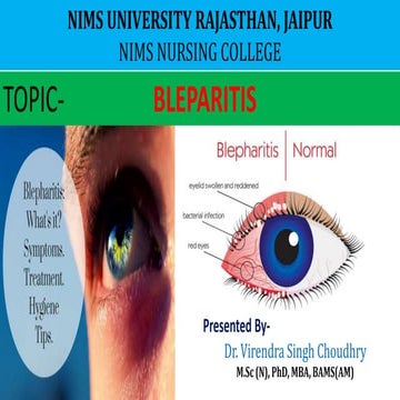 Blepharitis Eye disorder Medical Surgical Nursing-II | PPTX