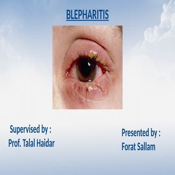 BLEPHARITIS presentation in ophthalmology.pptx
