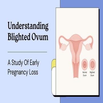 POWERPOINT PRESENTATION ABOUT BLIGHTED OVUM | PDF