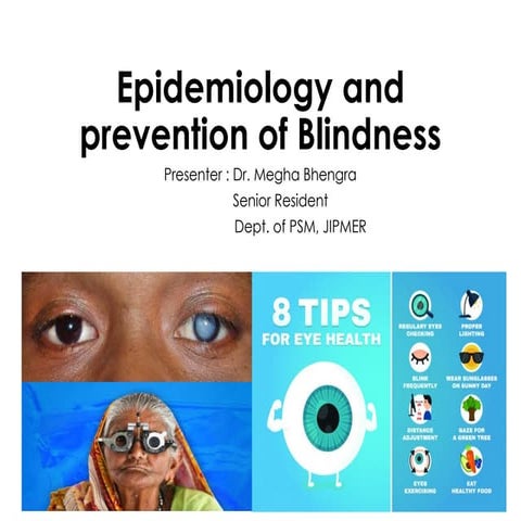 Global Blindness: Epidemiology and visual impairment | PPTX