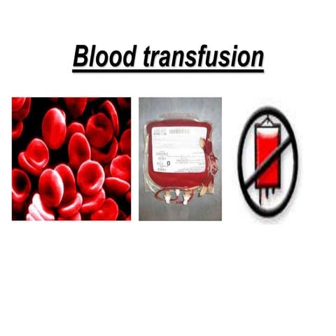 Blood transfusion basics | PPT