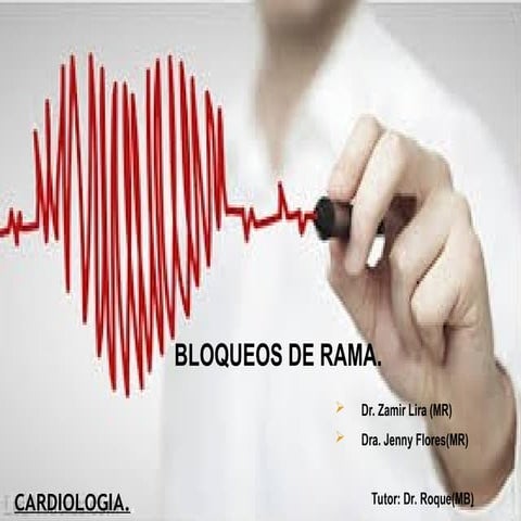 Bloqueos de rama y fasciculares. Electrocardiograma | PPTX