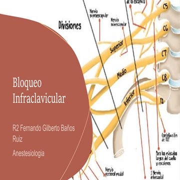Bloquo infraclavicular expo 2024 ......... | PPTX