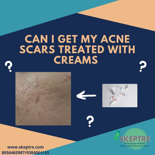 SCARS TREATMENTS | PDF