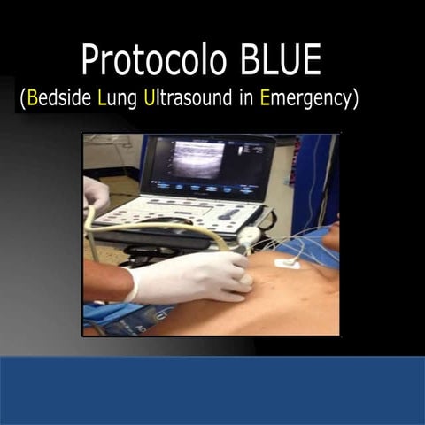 Blue protocolo | PPTX