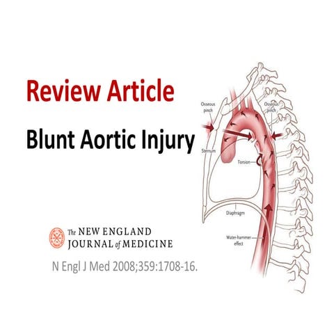 Blunt Aortic Injury | PPTX