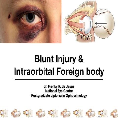 Ocular Blunt injury | PDF