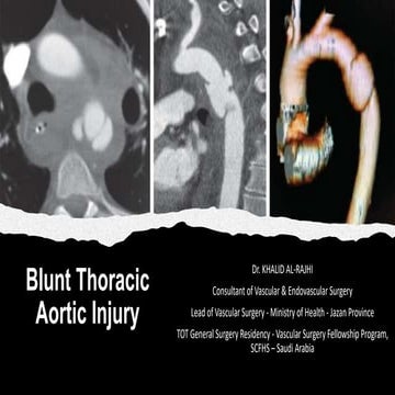 Blunt Thoracic Aortic Injury BTAI | PPT