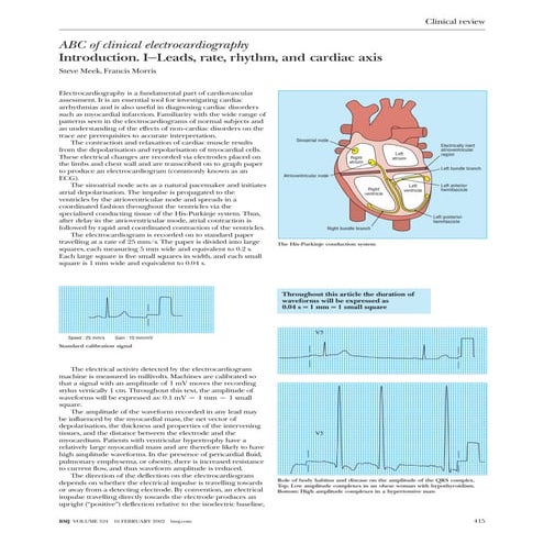 Electrocardiographymain | PPT