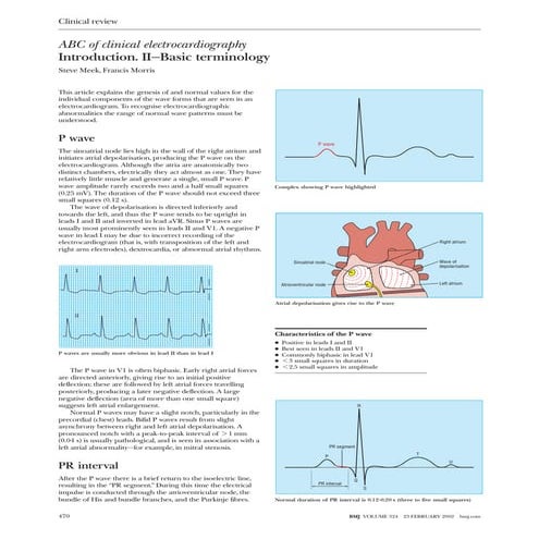 J POINT IN ECG AND ITS INERPRETATION IN ECG | PPTX