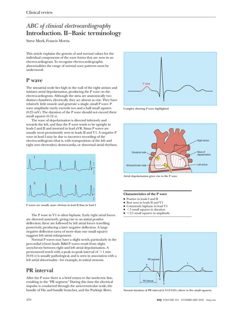 Q WAVE IN ECG,CAUSES OF PATHOLOGICAL Q WAVES | PPTX | Heart and Cardiovascular Diseases ...