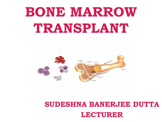 Bone marrow transplant | PPT