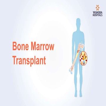 Bone Marrow Transplant in India | Bone Marrow Transplantation in ...