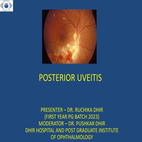 POST_UVEITIS_FINAL resentation dhir hospital bhiwani.pptx