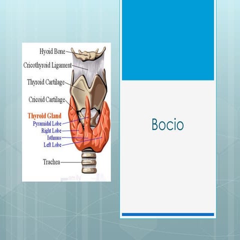 Bocio | PPTX