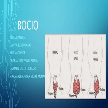 Bocio | PPTX