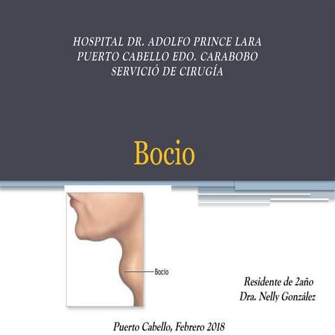 Bocio y nodulos tiroideos | PDF