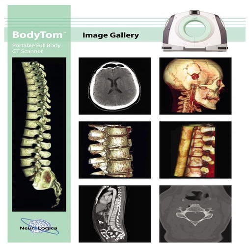 Body tom image gallery | PDF