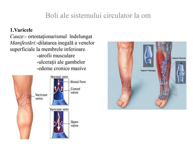 Referat necesitate model | DOC